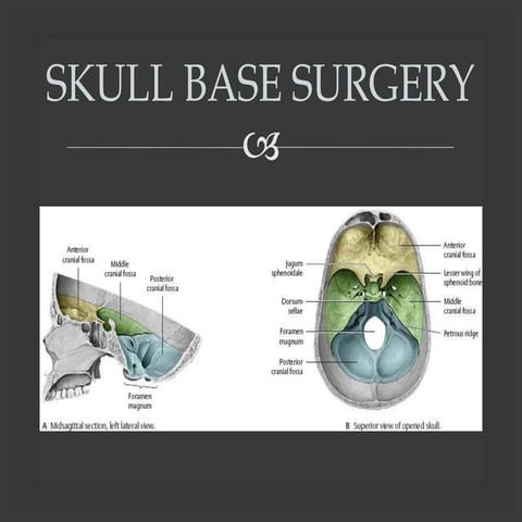 SKULL BASE SURGERY.pptx