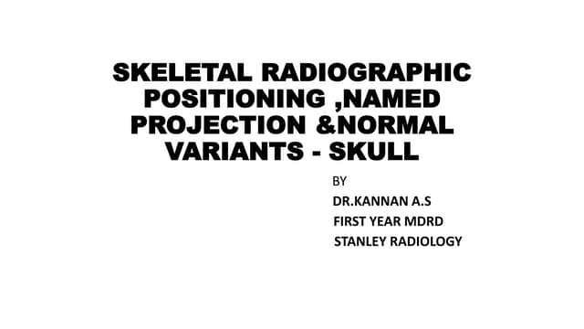 TOWNE VIEW of the skull. X-ray special procedure of skull. | PPTX