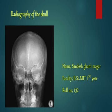 Skull radiography by sandesh Magar | PPTX