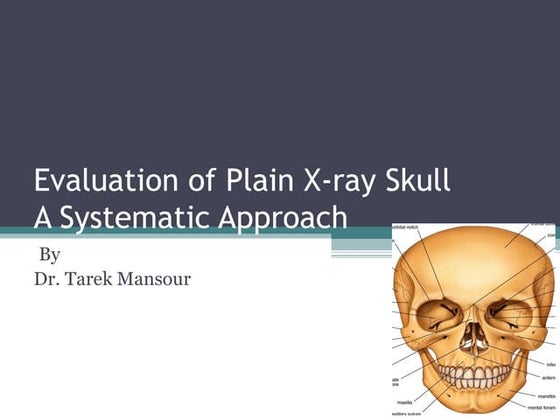TOWNE VIEW of the skull. X-ray special procedure of skull. | PPTX