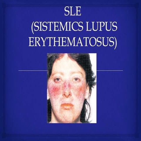 SLE | PPTX