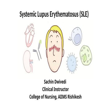 Systemic lupus erythematosus (SLE) | PPTX