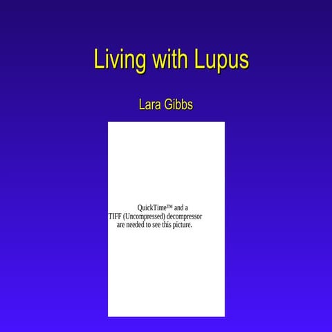 SLE: Case Presentation | PPT