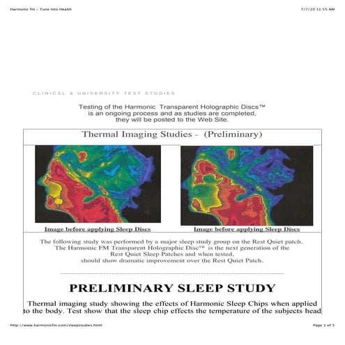 Sleep Study | PDF