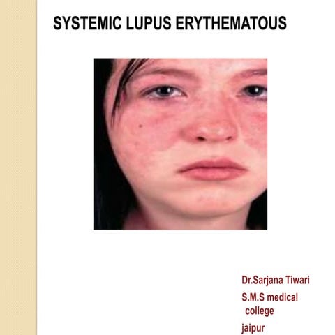 Sle presentation | PPTX