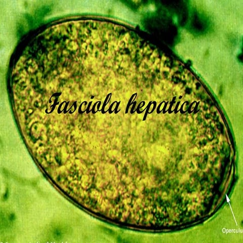 The Fasciola Hepatica - medical prasitology | PPTX