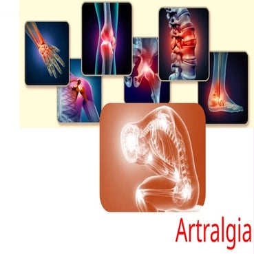 Comprehensive Overview of Arthralgia: Causes, Diagnosis, and Treatment ...