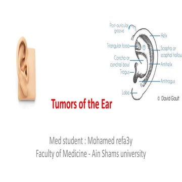 common middle ear tumors | PDF