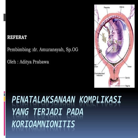 Slide referat obgyn 28 september 2011 | PPTX