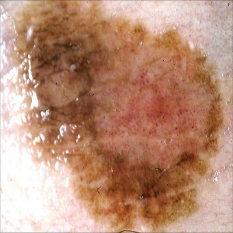 Slides 161 170 | PPT