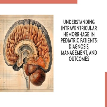 Intraventricular Hemorrhage in pediatrics | PDF