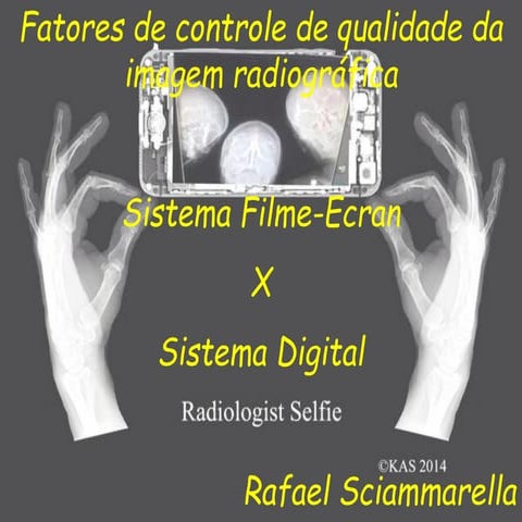 Fatores de controle de qualidade da imagem: Sistema filme-ecran X ...