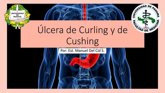 Ulcera de cushing y curling | PDF