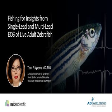 Fishing for Insights from Single-Lead and Multi-Lead ECG of Live Adult ...
