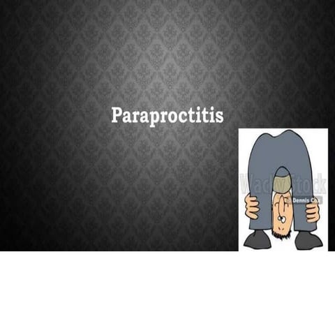 sSsidessaver.com.ppt.pptx Paraproctitis. | PPTX