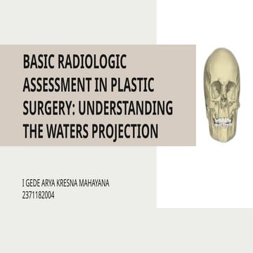 clinical use of waters projection in determining sinus problems | PPTX