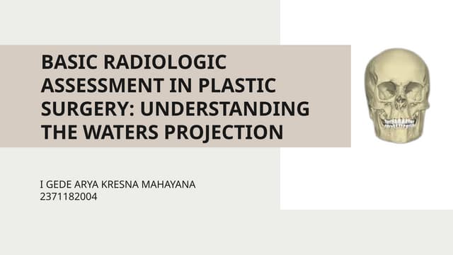 Radiology of nose and paranasal sinuses | PPTX