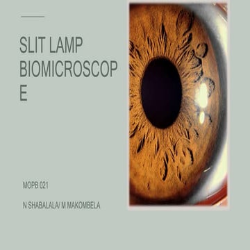 slitlamp examinations of Anterior Chamber.pptx
