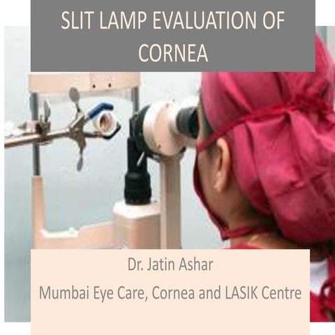 Slit Lamp Evaluation of Cornea | PPTX