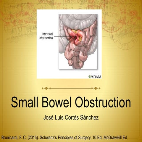 Small bowel obstruction and Intestinal Fistulas | PPTX | Digestive ...