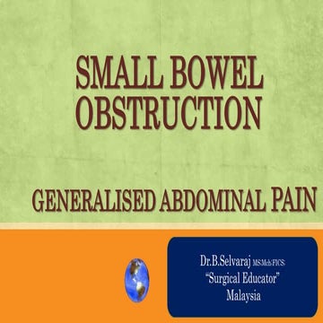 Small bowel obstruction/ Generalised abdominal pain | PPTX