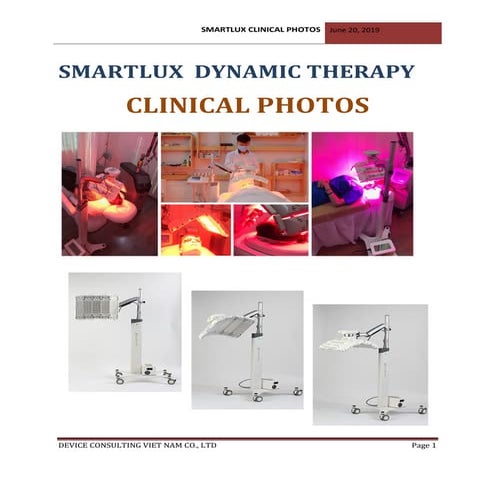 Smartlux Dynamic Therapy Clinical Photos | PDF