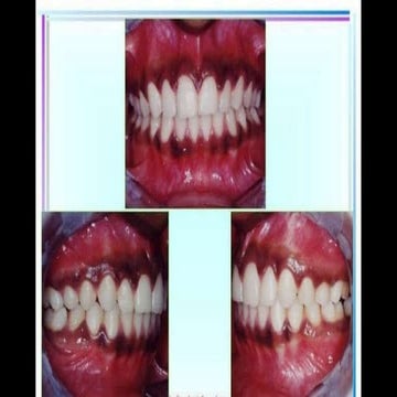 SMILE.pptx