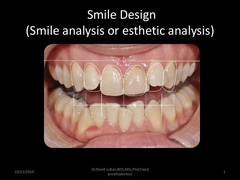 Smile analysis and digital smile design