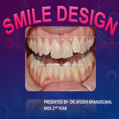 Smile analysis and digital smile design | PPT