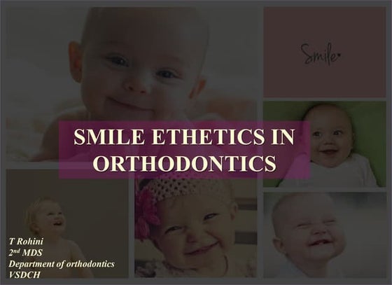 Clinical facial analysis (cfa) for orthodontists | PPT