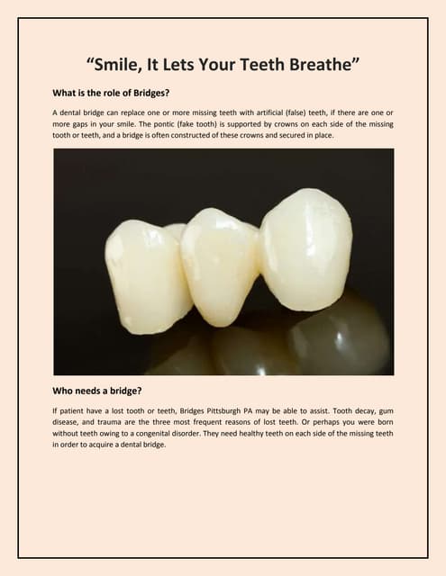 Dental Bridges And It's Types Explained Simply | PPTX
