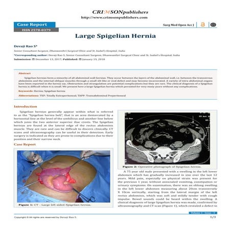 Large Spigelian Hernia | PDF