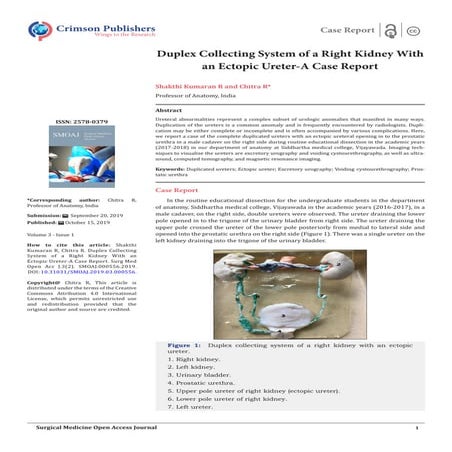 Double Collecting System, A Rare Disease Diagnosis and Management: A ...