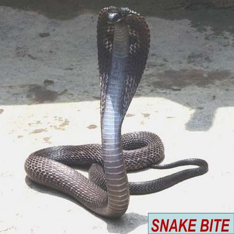 Snake bite and its management- Mayank Kumar Dubey (Forensic/DNA Expert ...