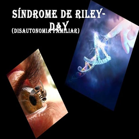 Síndrome de Rilay Day | PPT
