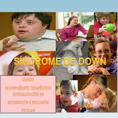 Síndrome de down power point | PPTX