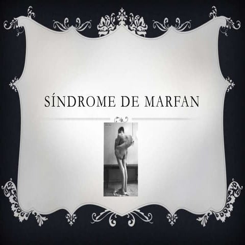 Sindrome de marfan | PPTX