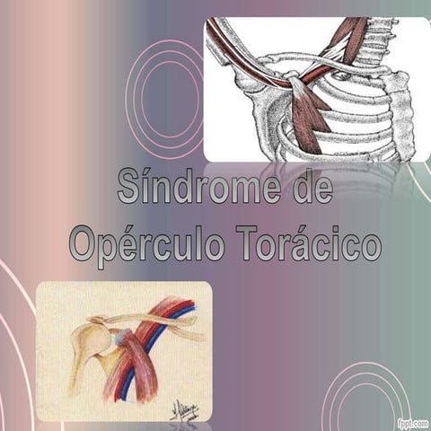 Síndrome de opérculo torácico y tratamiento en terapia ocupacional | PPTX
