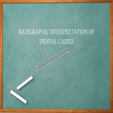 Radiographic interpretation in dental caires | PPTX
