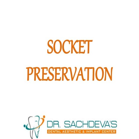 Socket Preservation | Ridge Preservation | PPTX