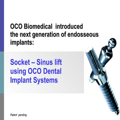 Socket sinus lift | PPTX