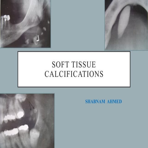 SOFT TISSUE CALCIFICATIONS.pptx ( oral medicine and Radiology) | PPTX