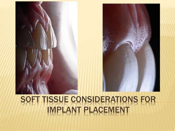 Free gingival graft | PPT