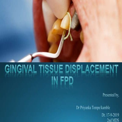 Gingival retraction.pptx