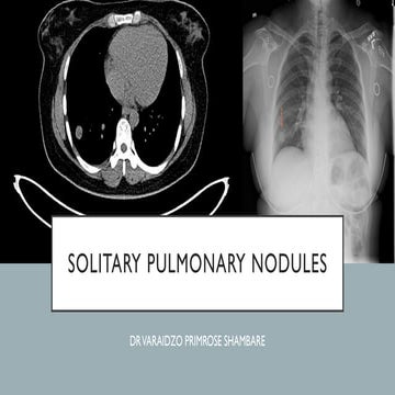 Understanding Solitary pulmonary nodules.pptx