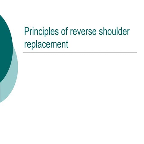 Reverse Total Shoulder Replacement: Anatomy, Rehabilitation, and ...