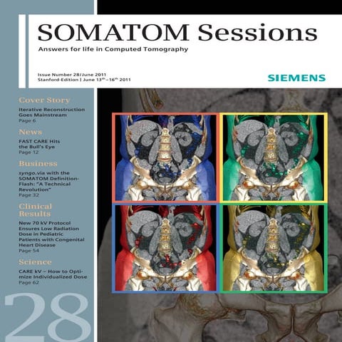 Somatom session 28 | PDF