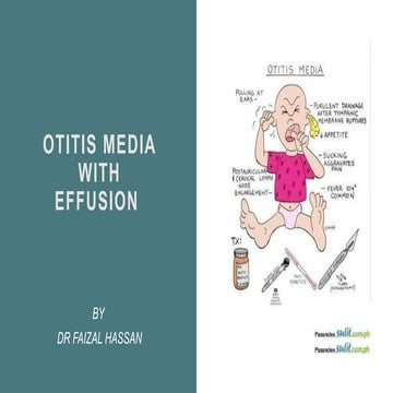Serous Otitis media and Grommets | PPTX