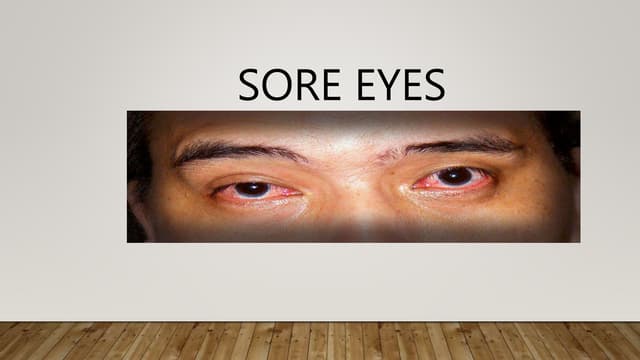 Dry Eyes educational pamphlet for patients | DOCX