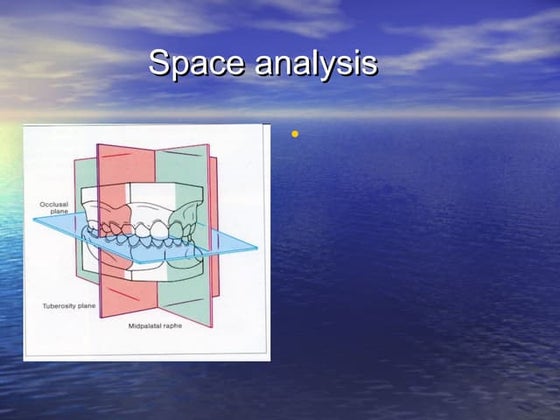 Bolton analysis and mixed dentition analysis | PPT